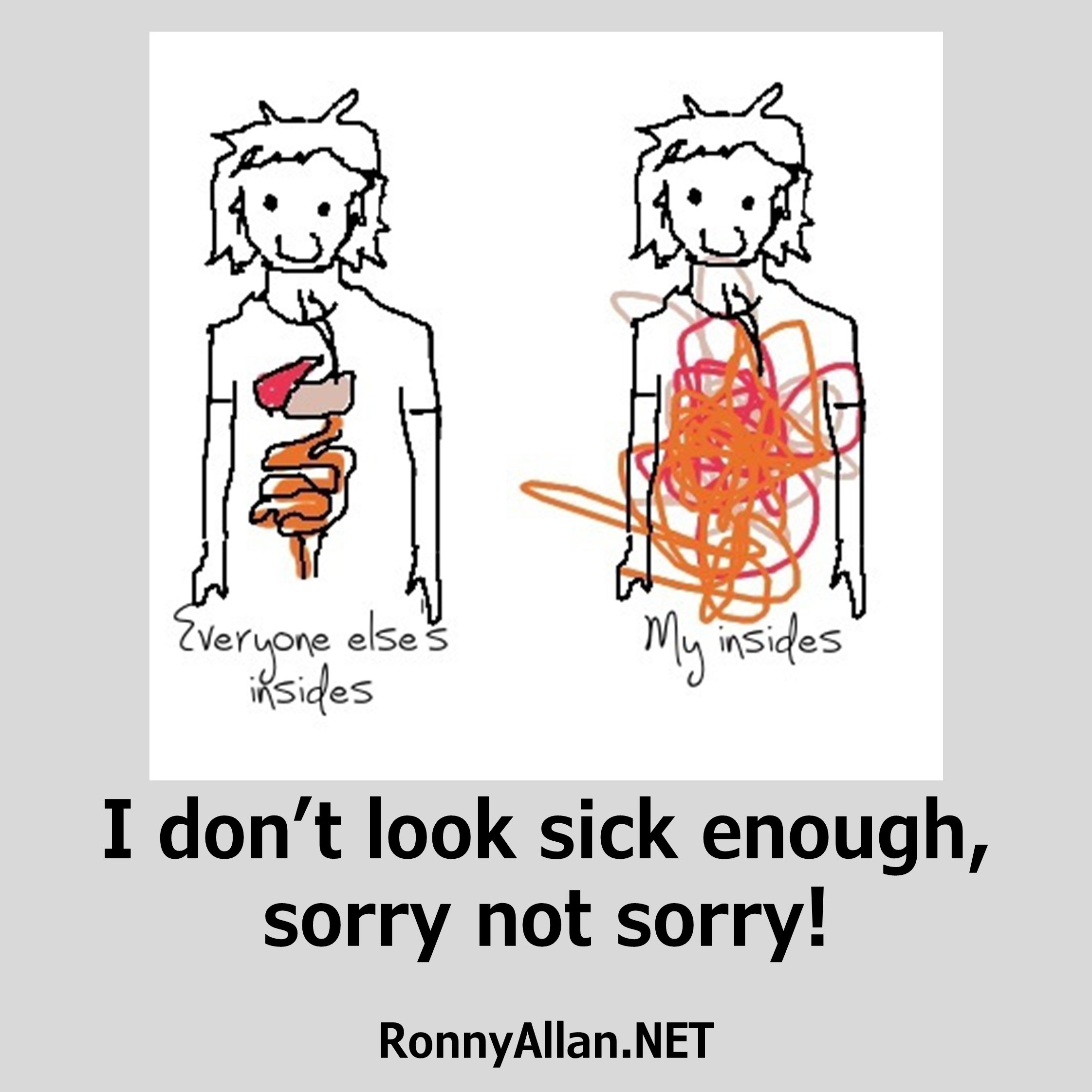 I don't look sick enough, sorry not sorry - Ronny Allan - Living with ...