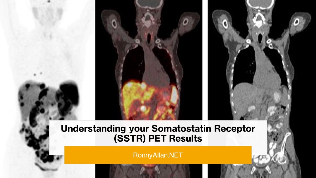 Understanding your Somatostatin Receptor (SSTR) PET Results - Ronny ...