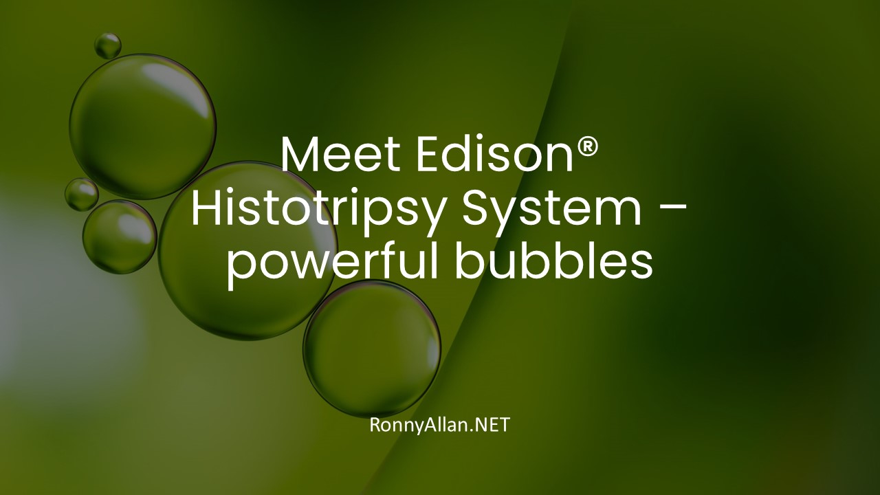Meet Edison® Histotripsy System - powerful bubbles - Ronny Allan ...